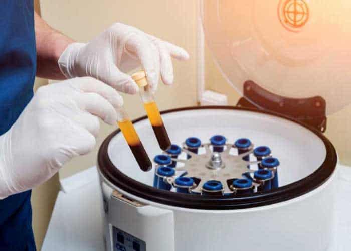 PRP Orthopedic Injections | Blood Platelet Injection Therapy | Westlake ...